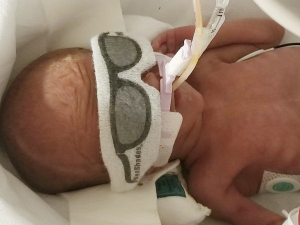 Neonatal ET Tube Support: NeoBar - Neotech Products